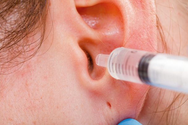 3 astuces pour nettoyer ses oreilles et enlever un bouchon de cérumen